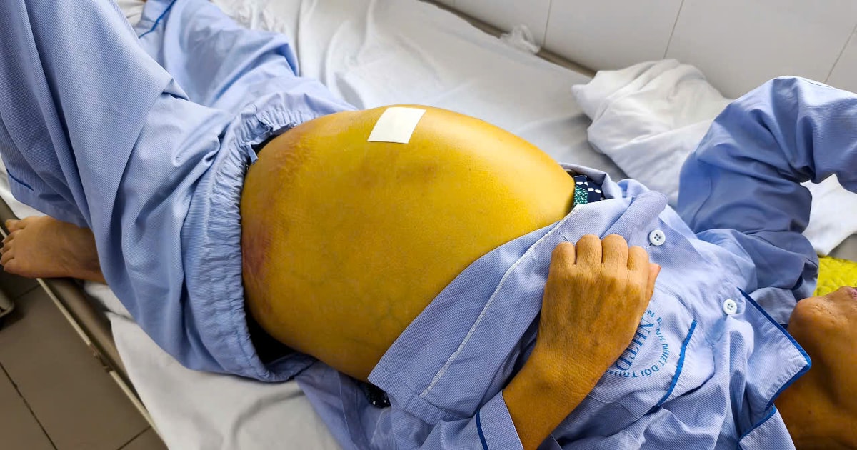 Ph%c3%a1t%20hi%e1%bb%87n%20vi%c3%aam%20gan%20B%20mu%e1%bb%99n,%202%20b ...