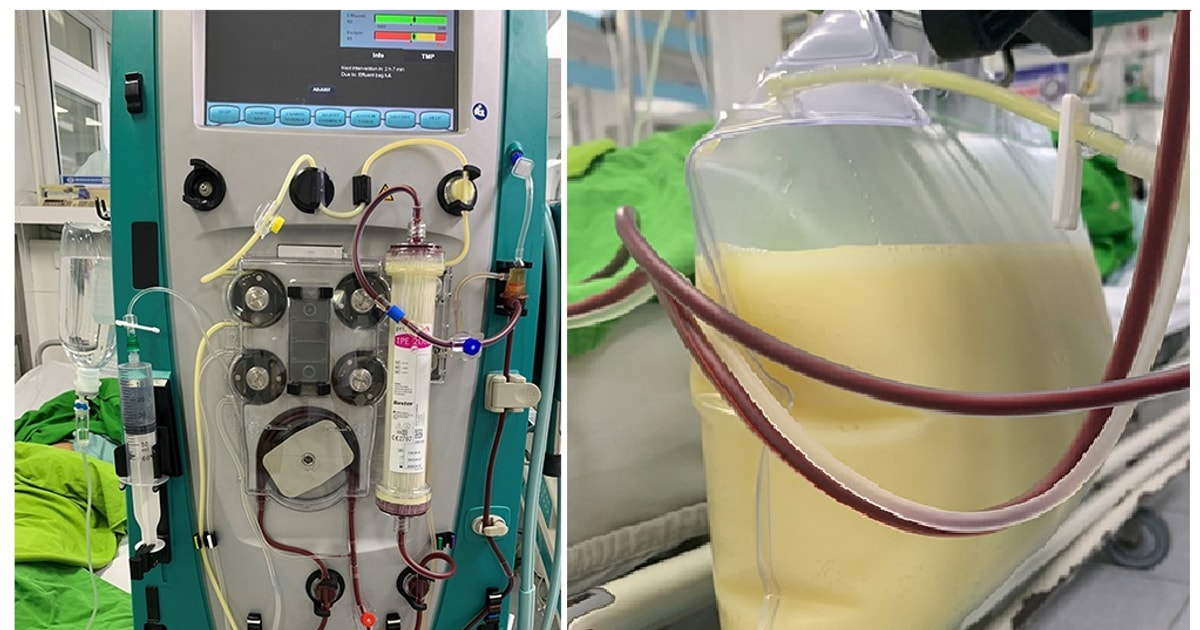 M%e1%bb%a1%20m%c3%a1u%20cao%20xu%e1%ba%a5t%20hi%e1%bb%87n%20%e1%bb%9f ...